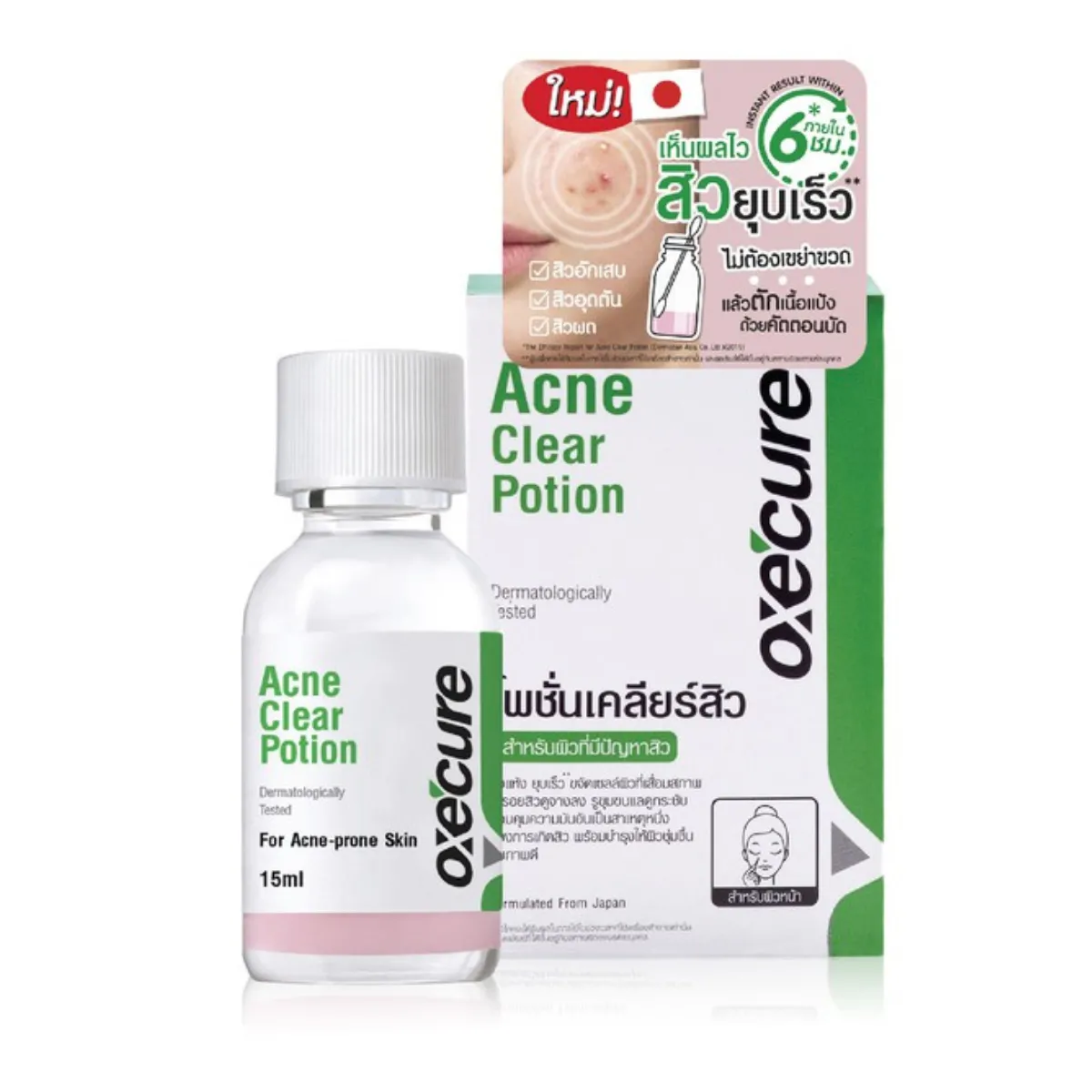 รวมลิสต์ 8 เจลเเต้มสิว สิวยุบไว ช่วยลดรอยแดง ไม่ทำให้ระคายเคือง 2024